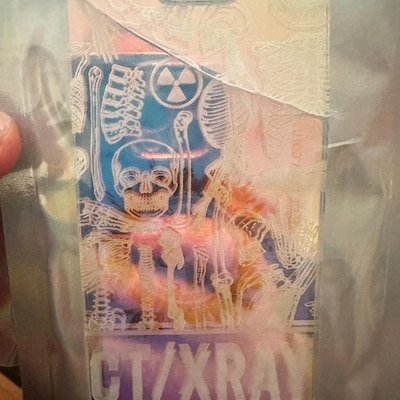 Set of 10 R and L Lead Letters for X-ray Markers Unmounted Flat Face ...