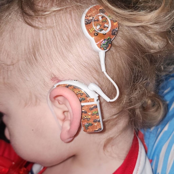 Cochlear N8 Skin Digital File - Etsy