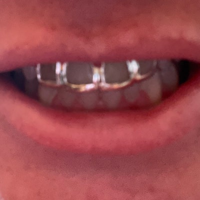 Silver Grillz 925 Sterling Silver Teeth Real Open Face Silver Grill - Etsy