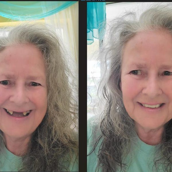 Retainers Customize for a Perfect Fit 1 Save Lots of Money and Office ...