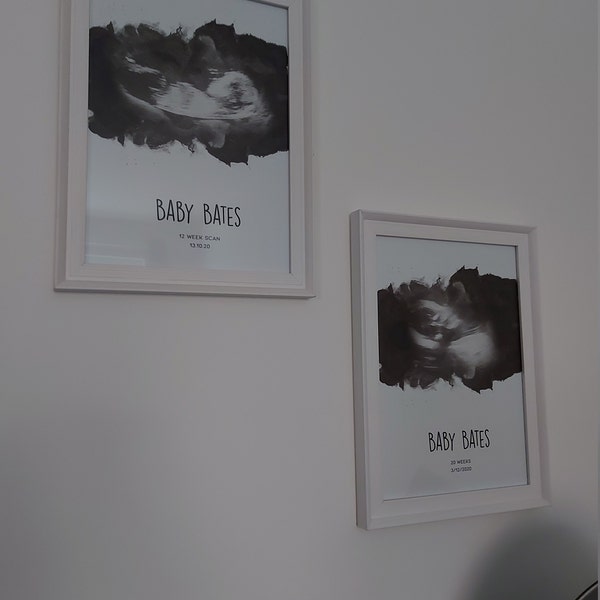 Personalised BABY Scan Ultrasound Watercolour Print 4D First Baby Scan ...
