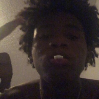 The BEST Mold Kits for Grillz Mold Impression Kit for Custom Grillz ...