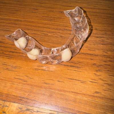 Great Fitting Retainer With Diamonds Customization or Logo.1 Top or ...