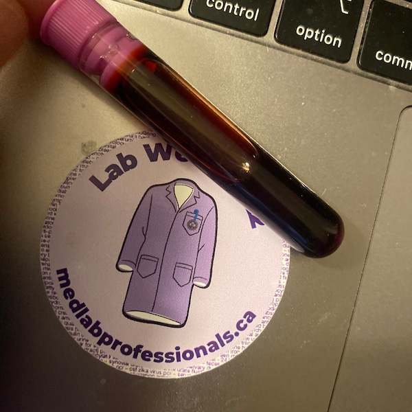 Blood Test Tube Keychain / Chemistry / Transfusion / Blood Bank ...