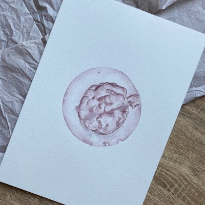 Embryo Art Ivf Painting Embaby Art Hand-painted Nursery Decor Fertility ...
