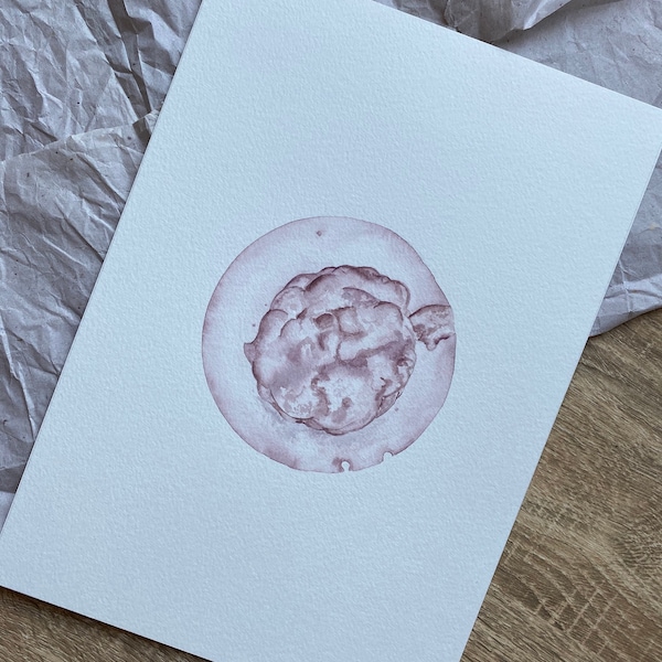 Embryo Art | Ivf Painting | Embaby Art | Hand-painted Nursery Decor ...