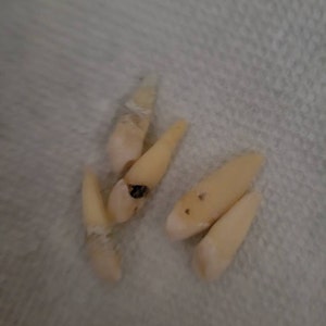 One Real Human Tooth Pendant Necklace - Etsy