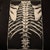 Ribcage Back Patch, Ribcage, Skeleton Patch, Bones Patch, Cloth Patch, Spine, Back Patch, Canvas ...
