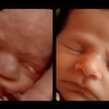 Ultrasaund 8k Baby Image 3d 4d 5d 8d Real View Baby AI Photo ...