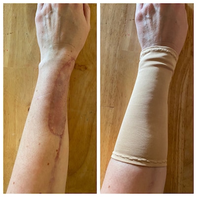 Long Light Skin Unisex Arm Tattoo Scar Cover - Etsy