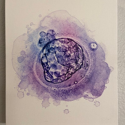 Embryo Art Custom Canvas Print IVF Baby Pregnancy Announcement - Etsy