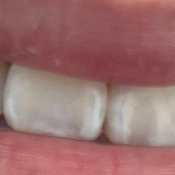 Gold Sparkle Tooth Gem - Etsy