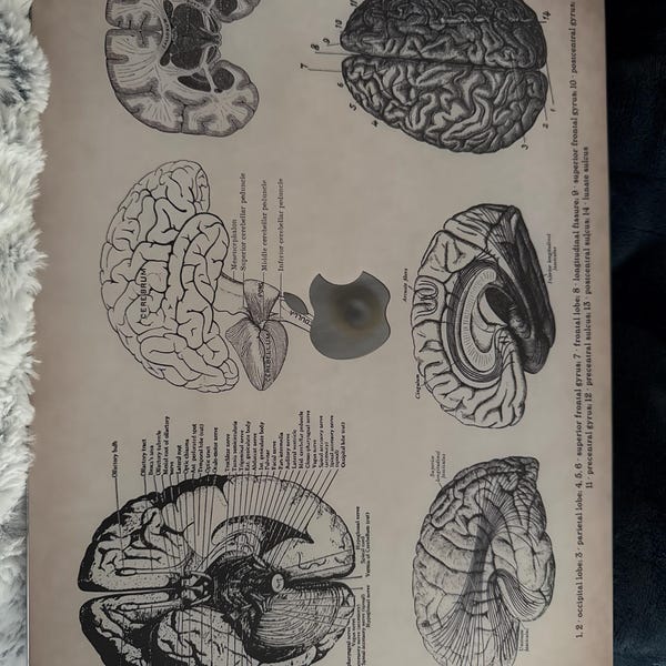 Brain MacBook Case Anatomy MacBook Air 13 15 M2 M3 MacBook Pro 13 14 16 ...