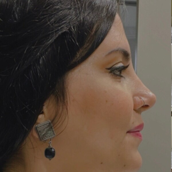 Pahlavi Coin Necklace Adorned With Four Old Fashion Yek Geroonie Coin ...