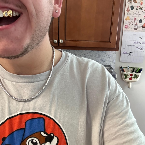 Custom 10 Piece Grillz Set With Trillion Tips and Open Windows in Two ...