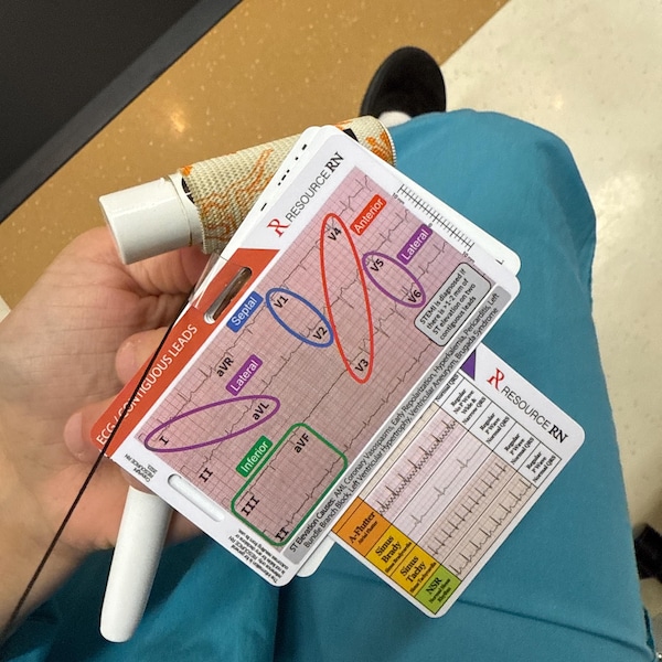 EKG STEMI Reference Tool - Horizontal and Vertical Badge Card Pocket ...