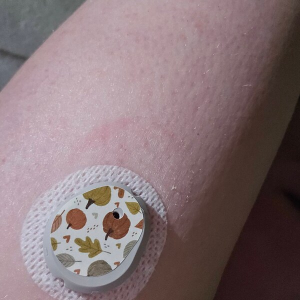 Omnipod Dash PDM Sticker "wildflowers" | decorate Your Devices | Type 1 ...