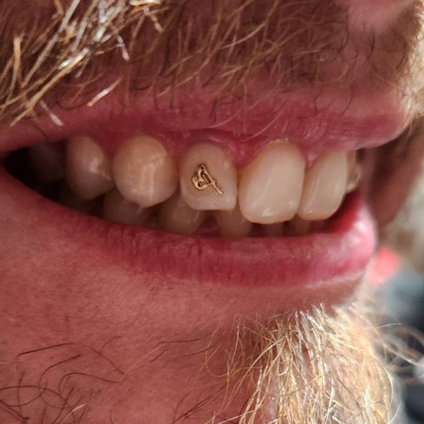 18k Gold Tooth Gems - Etsy