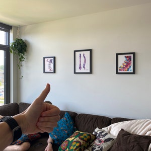 Gait Analysis Pattern Poster Sandyspines Art for | Etsy