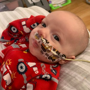 Ng Tube, Nasogastric or Oxygen Tube Adhesive Tape Length Floral MIX ...