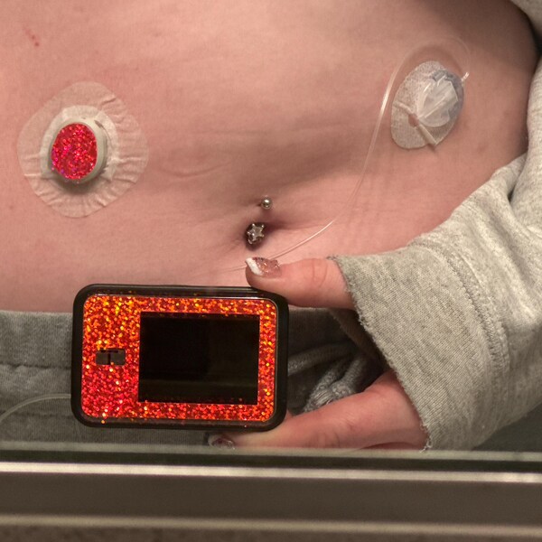 Dexcom G7 - T-slim Skin Decal - Tandem T-slim X2 Sticker - Dexcom G6 ...