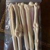 5 PC Ortho Bone Pens, Gifts Under 10,orthopedic Ballpoint Pen, Doctor ...