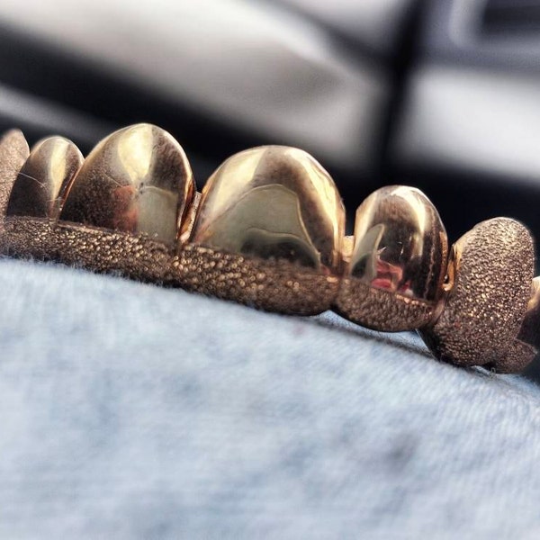 The BEST Mold Kits for Grillz Mold Impression Kit for Custom Grillz ...