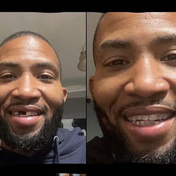 Retainers Customize for a Perfect Fit 1 Save Lots of Money and Office ...