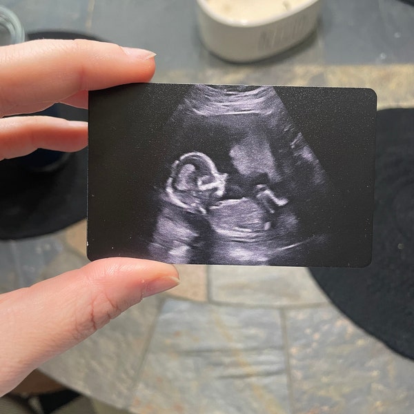 Baby Ultrasound Wallet Card for Dad, Wallet Insert Card for Daddy to Be ...