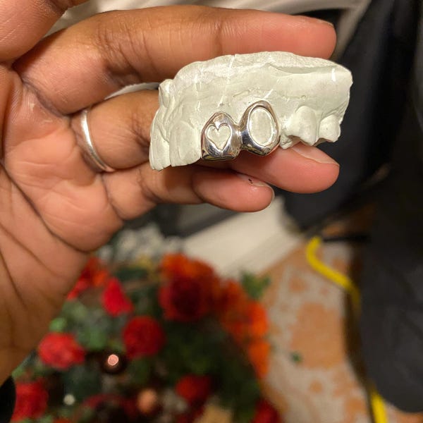 Custom Solid Gold Grillz / Permanent Cut / Deep Cut Custom Gold Grillz ...