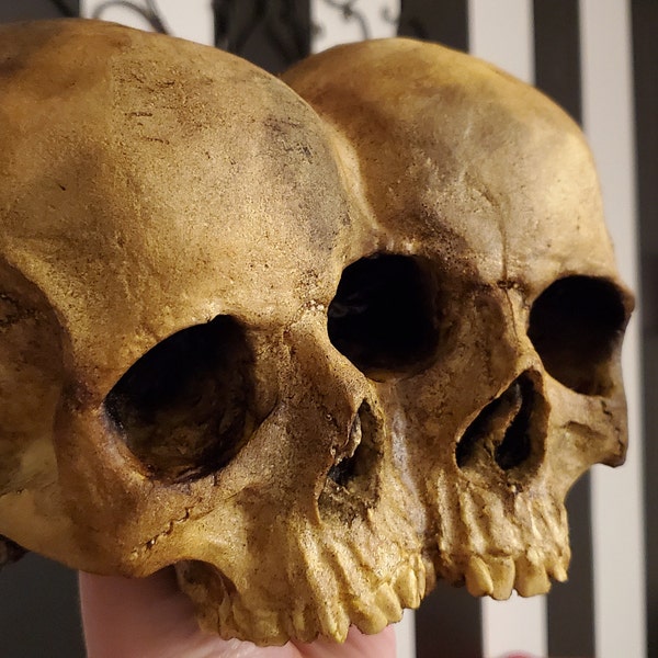 Conjoined Twins Human Skull **FREE SHIPPING* - Etsy