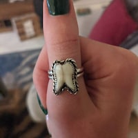 Your Own Custom Tooth Ring! - Etsy