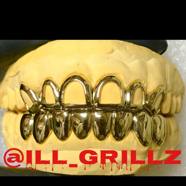 Handmade Custom Dental Gold Top Fangs With Bottom Wolf Style Grillz - Etsy