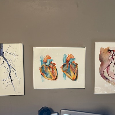 Coronary Angiogram Watercolor Print Cardiology Painting Heart Art ...
