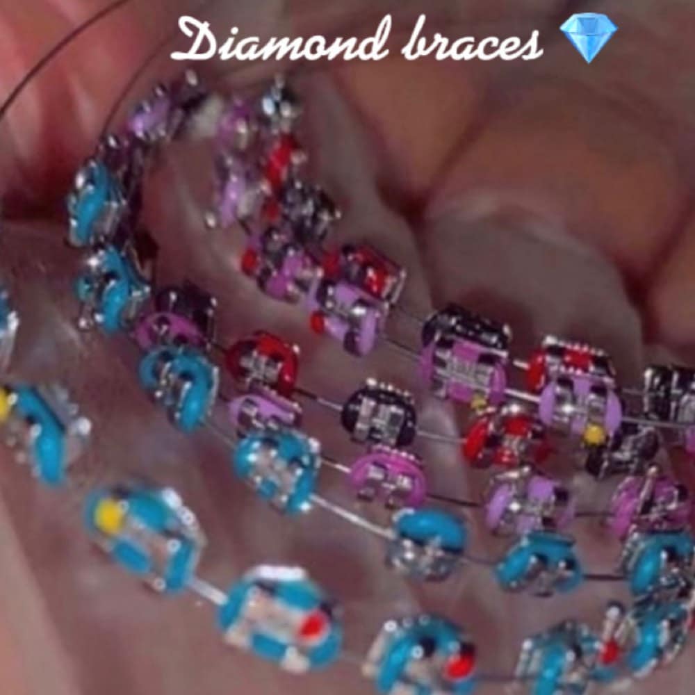 Diamondbraces - Etsy