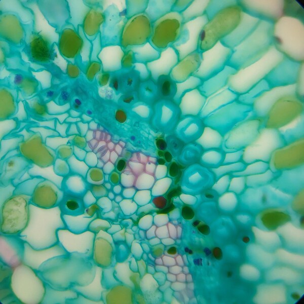 Microscopic Sponge Structure Canvas Wall Art - Etsy