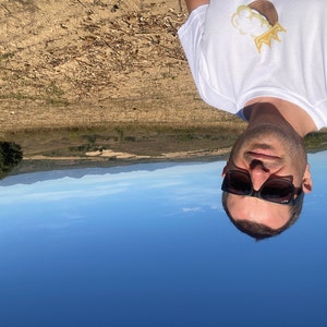 Authentic Greek Treasure: 100% Pure Chios Mastic Essential Oil Natural ...