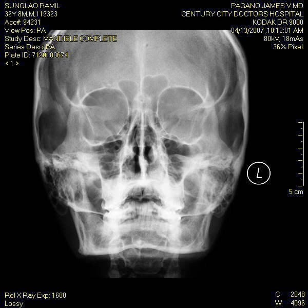 Basic Bracer Pattern Digital Download PDF - Etsy