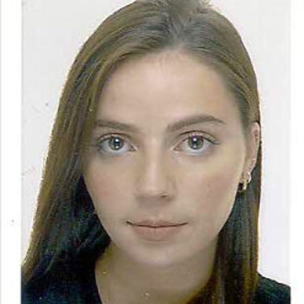 Lungs and Trachea Anatomy Printable Poster - Etsy